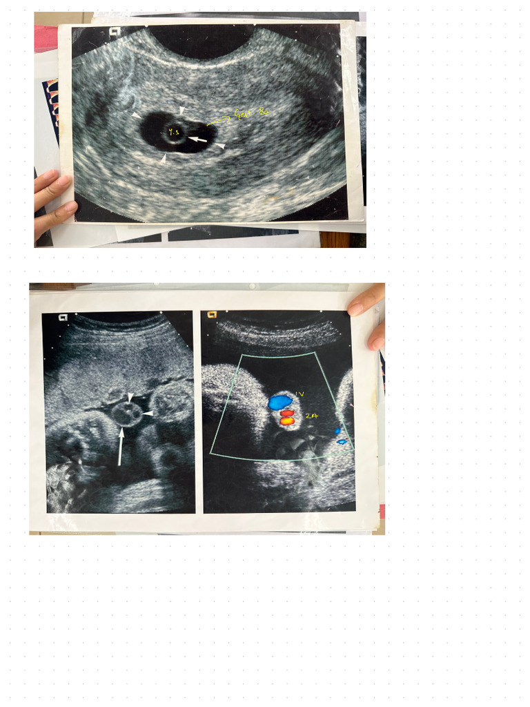 Obg Classes Theory | PDF