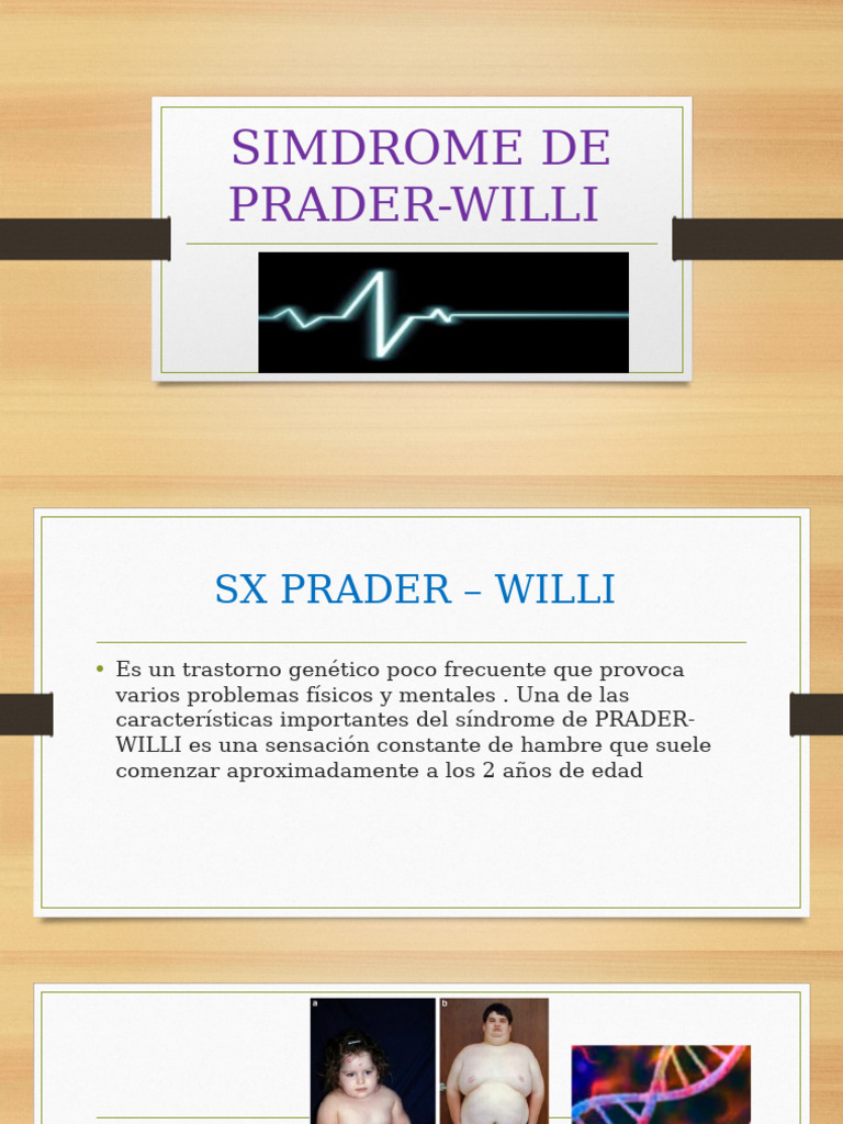 Síndrome de Prader-Willi: Causas y Síntomas | PDF | Adultos | Sistema ...