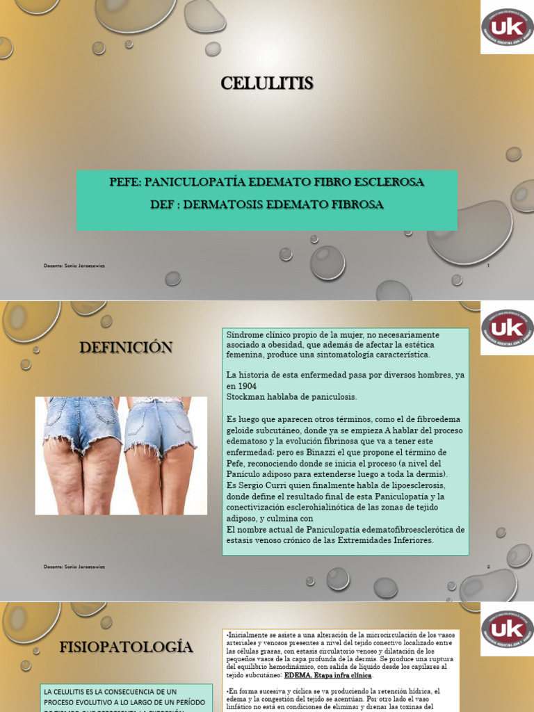 Celulitis Power | PDF | Tejido adiposo | Edema