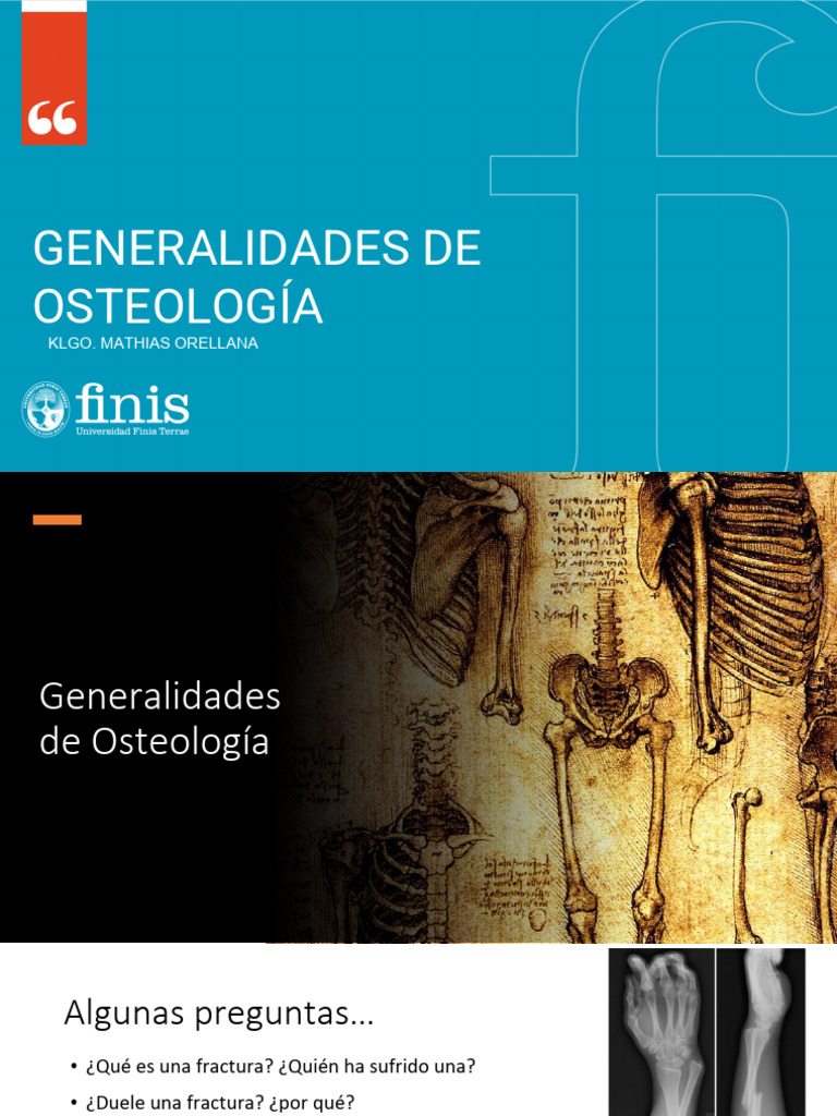 Introducción a la Osteología y Fracturas | PDF | Hueso | Anatomía