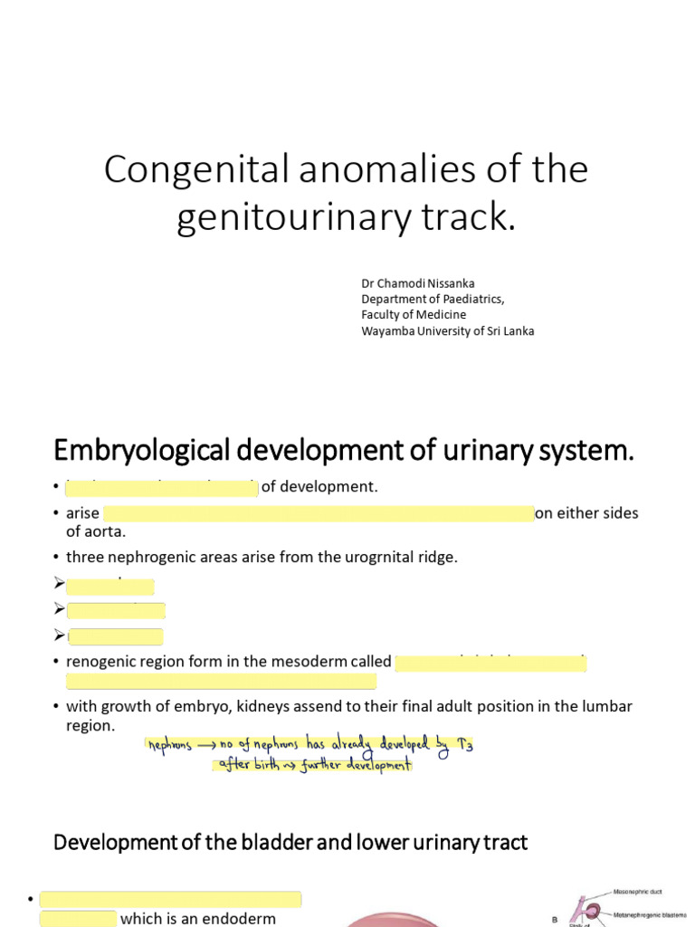 Congenital Anomalies of Genitourinary Tract - 241002 - 033432 | PDF ...