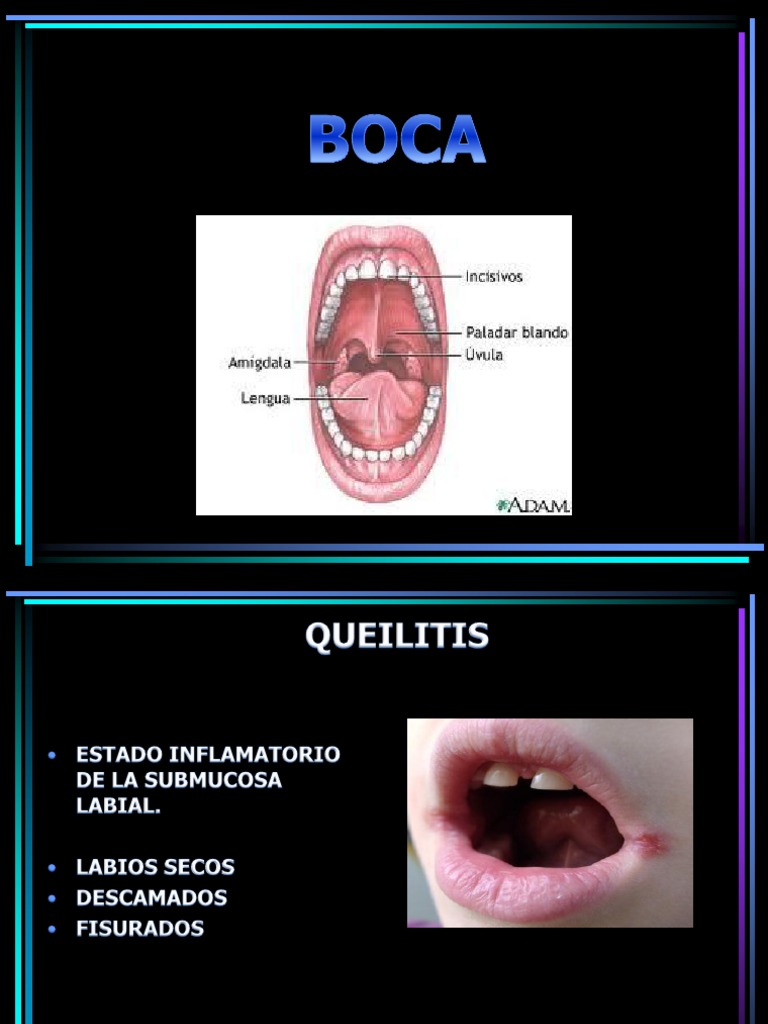 QUEILITIS | PDF | Gastroenterología | Enfermedades digestivas