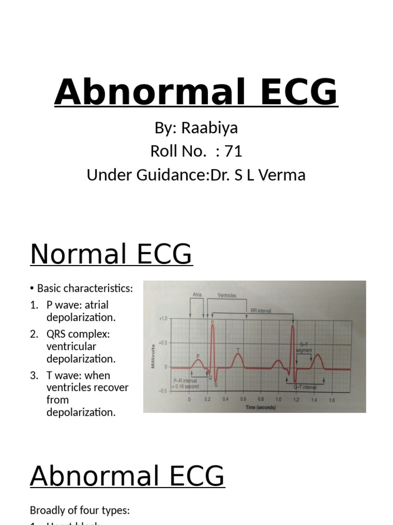 Understanding Abnormal ECG Patterns | PDF | Electrocardiography | Heart