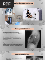 Protocolo Blue | PDF | Enfermedades y trastornos | Neumología