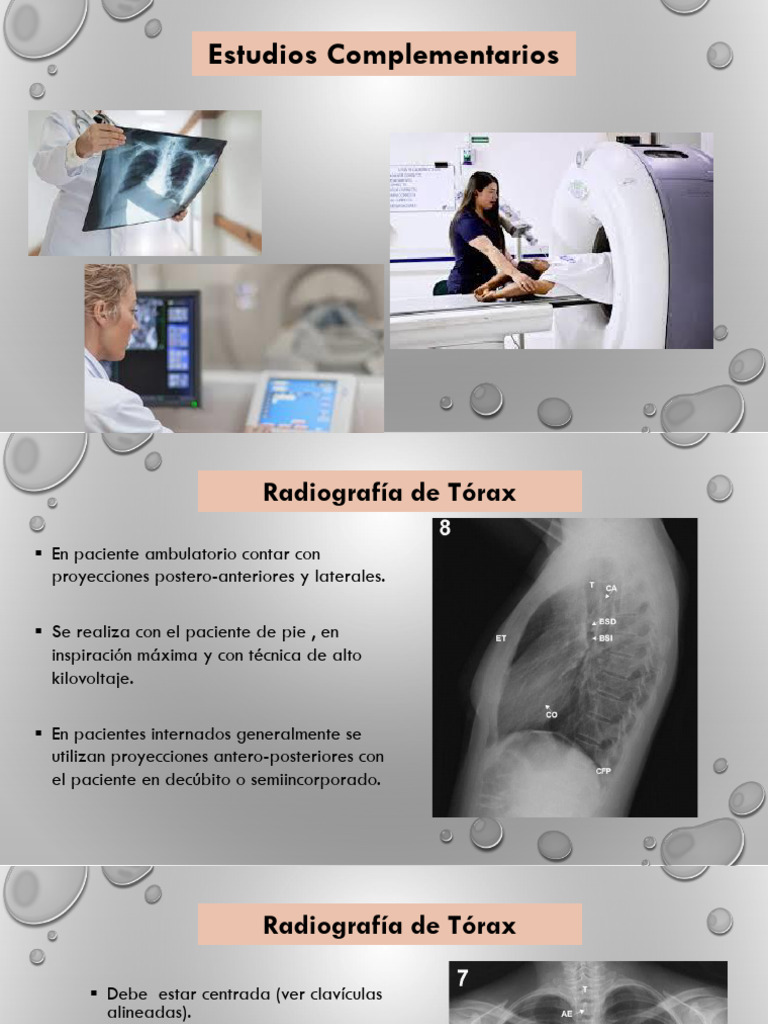 Estudios Complementarios Espirometria | PDF | Pulmón | Cáncer de pulmón