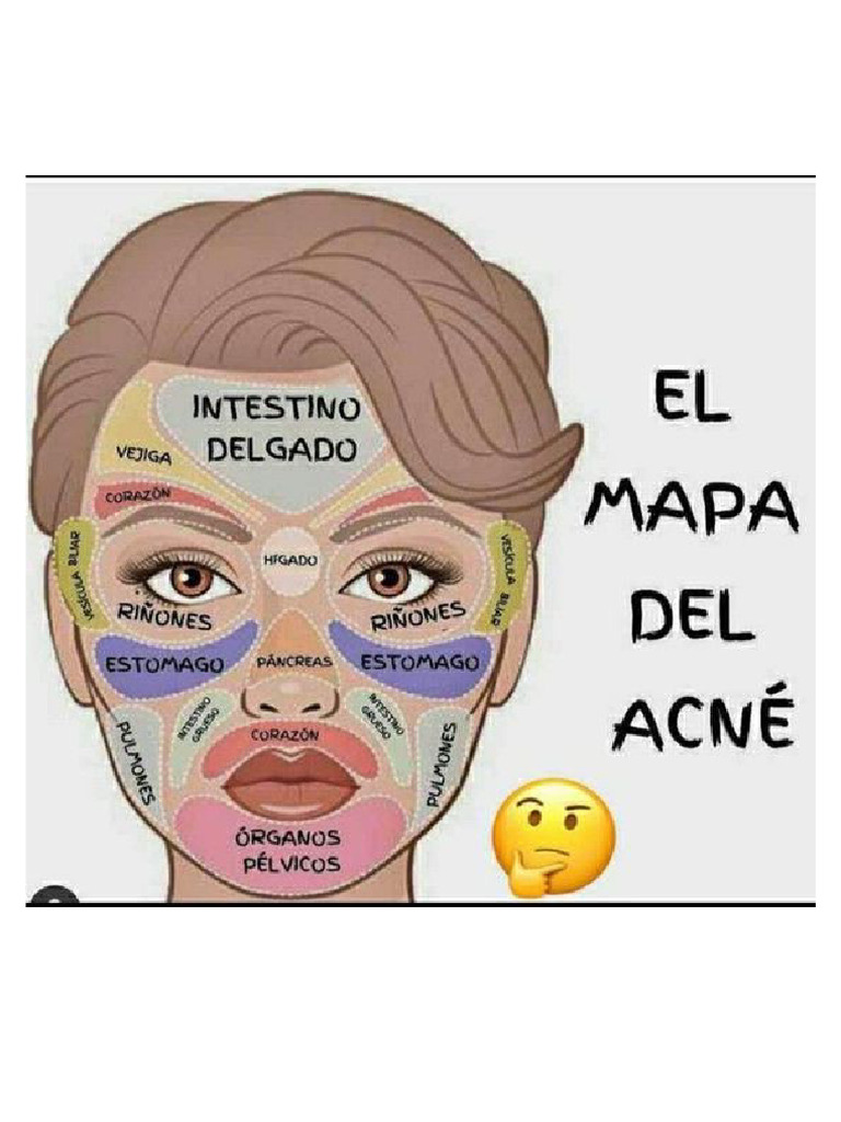 mapa del acne | PDF
