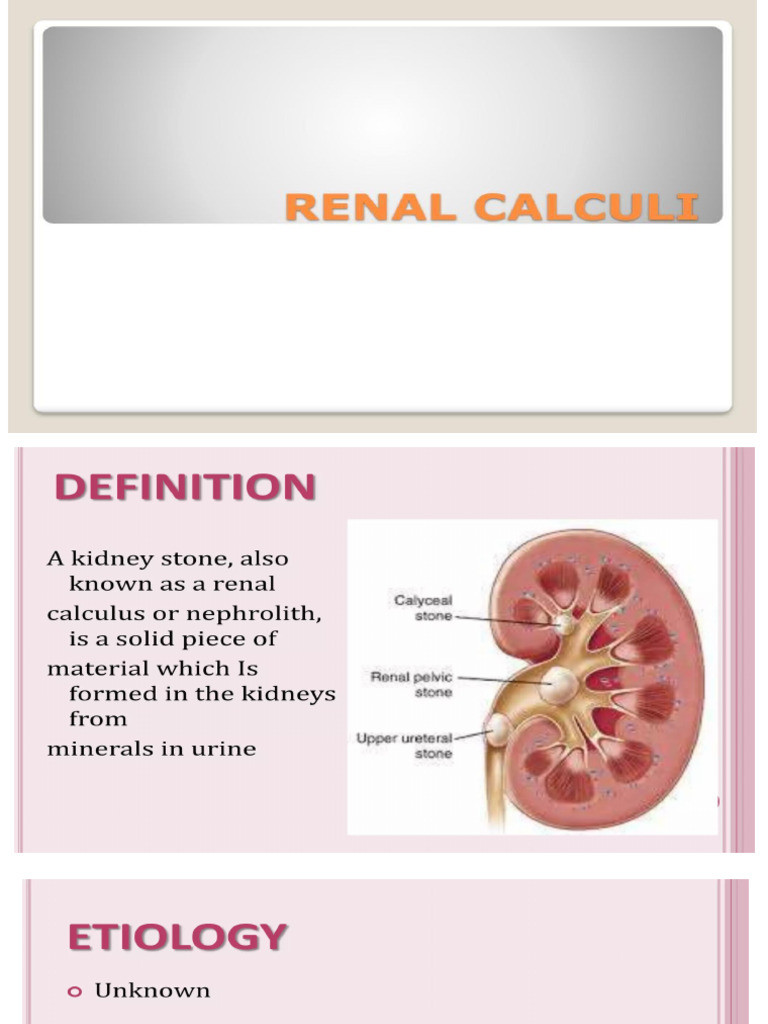 5. renal calculus | PDF
