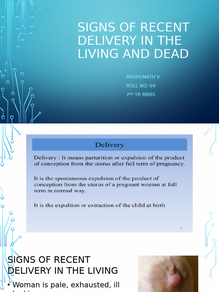 Signs of Delivery in the Living and Dead | PDF