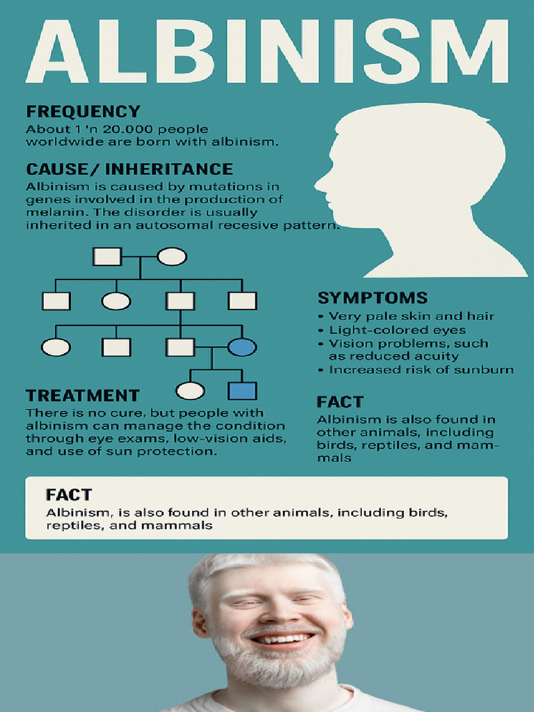 Understanding Albinism: Key Facts | PDF
