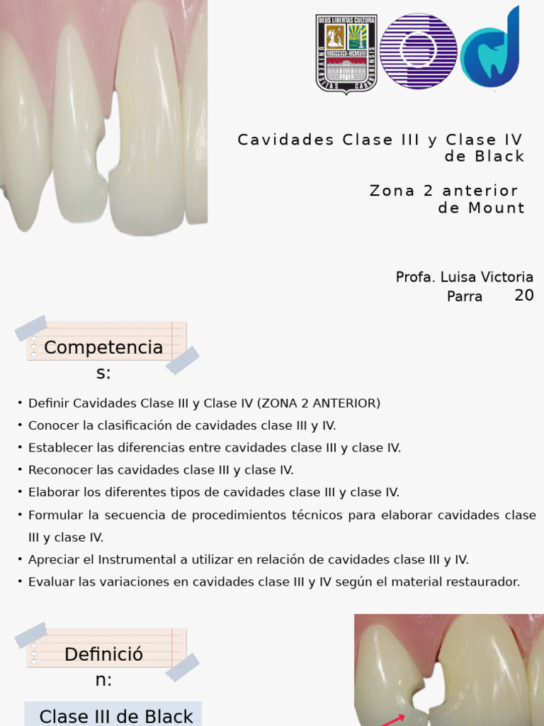 Cavidades Clase III y IV en Odontología | PDF | Odontología | Anatomia ...