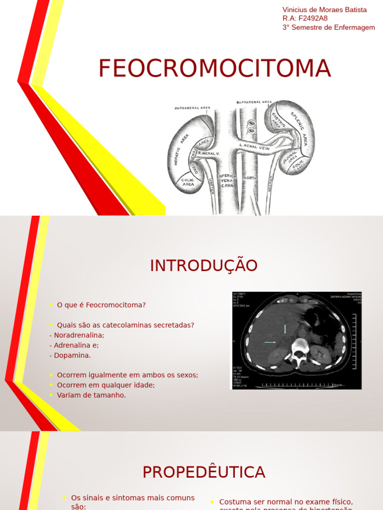 Slides - Feocromocitoma | PDF | Doenças e distúrbios | Especialidades ...