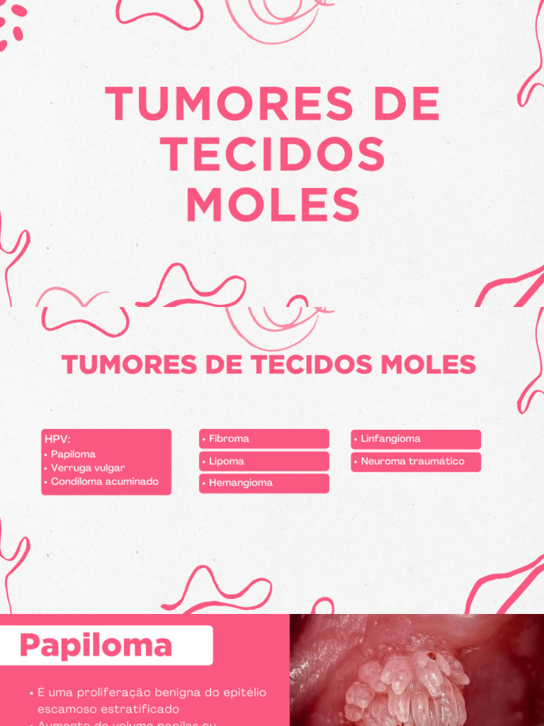 Tumores de Tecidos Moles | PDF