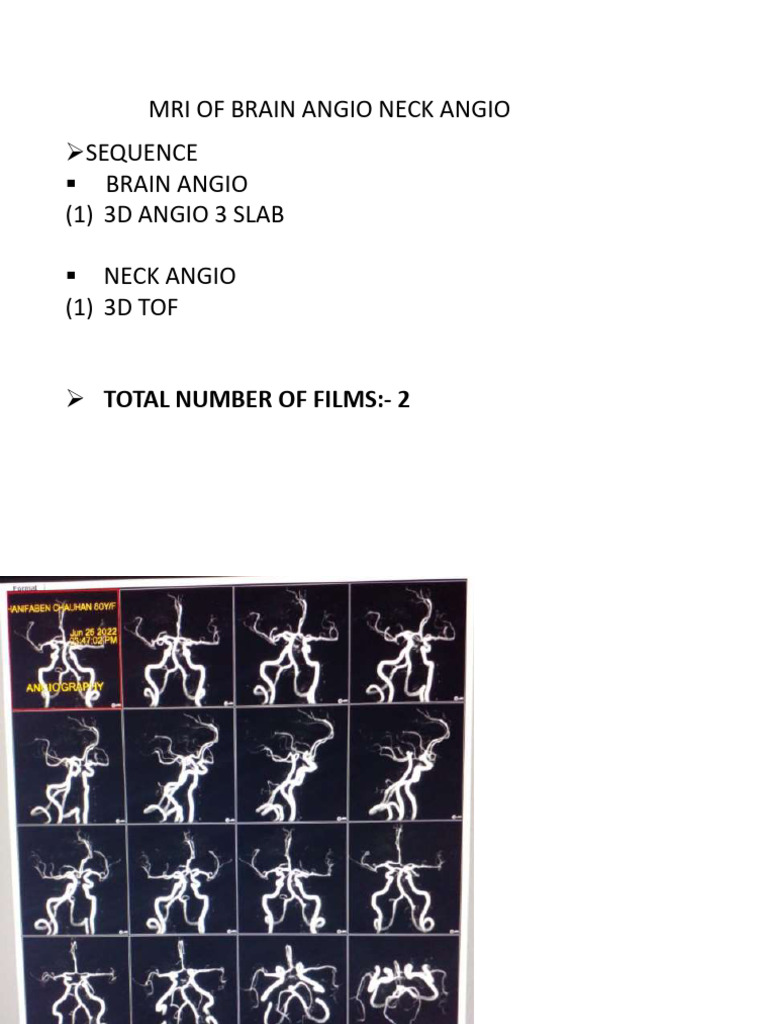 Brain Angio Neck Angio | PDF