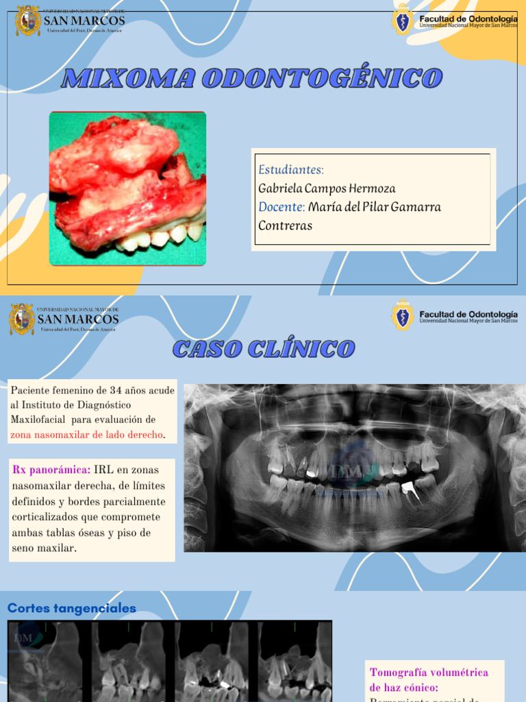 Mixoma Odontogénico: Caso Clínico y Diagnóstico | PDF