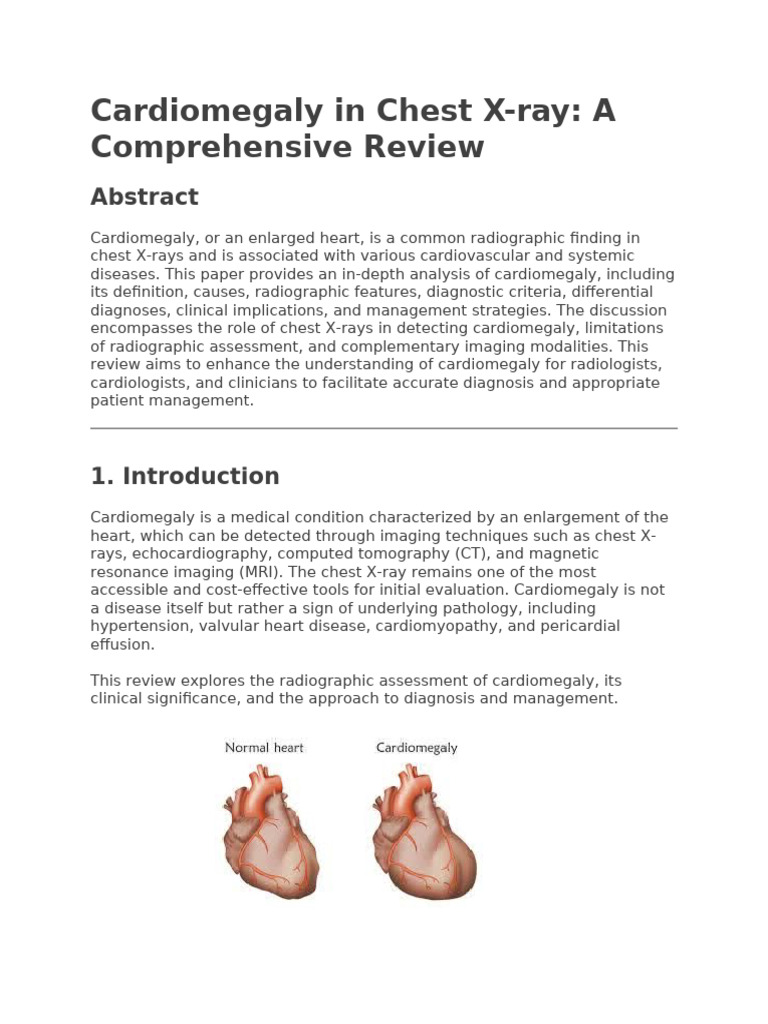 Understanding Cardiomegaly on Chest X-ray | PDF | Heart ...