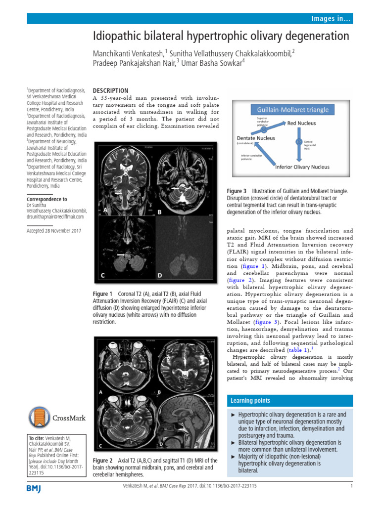 Hypertrophic Olivary Degeneration | PDF | Diseases And Disorders ...