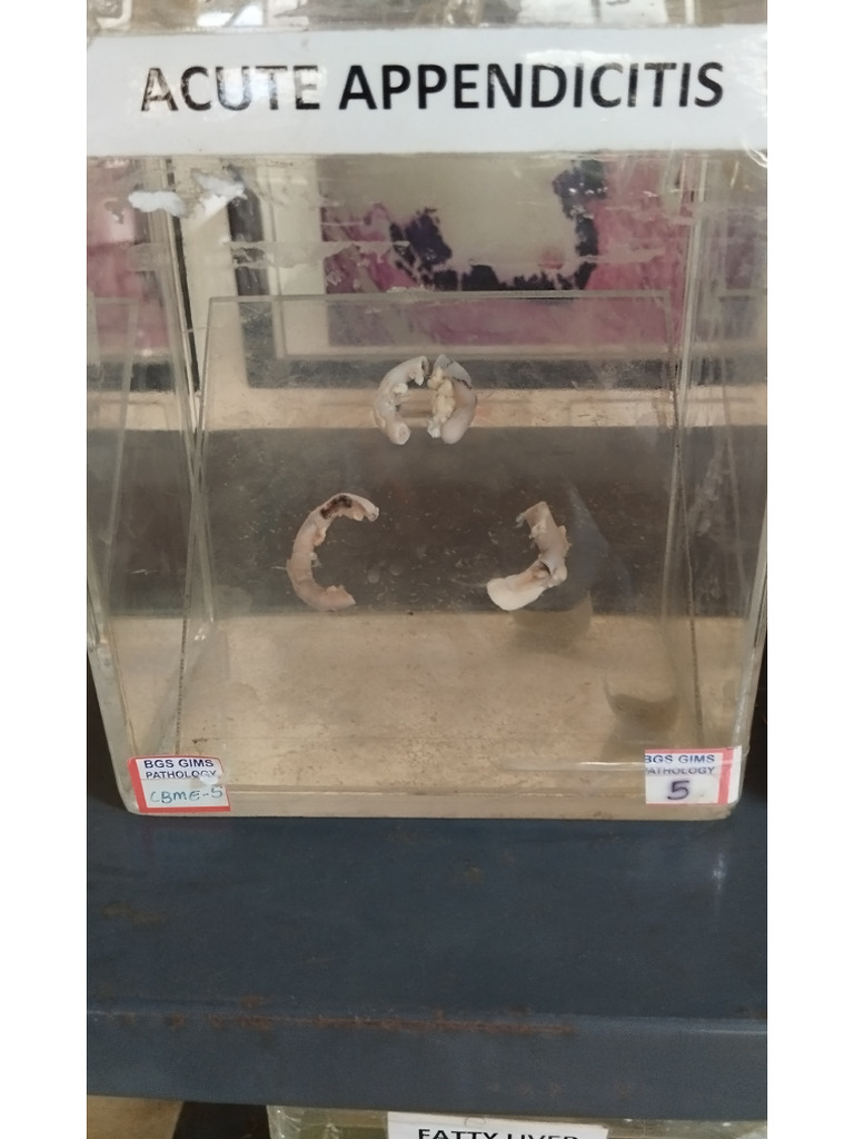 Pathology Gross Specimens 2 | PDF