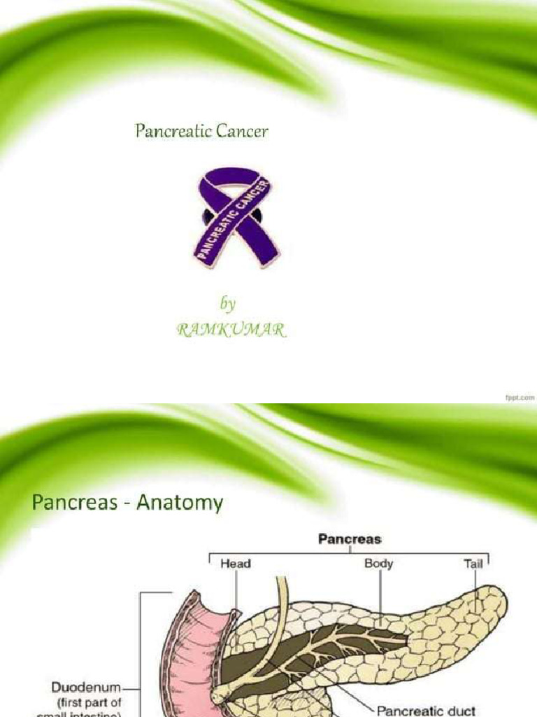 Pancreatic Cancer | PDF