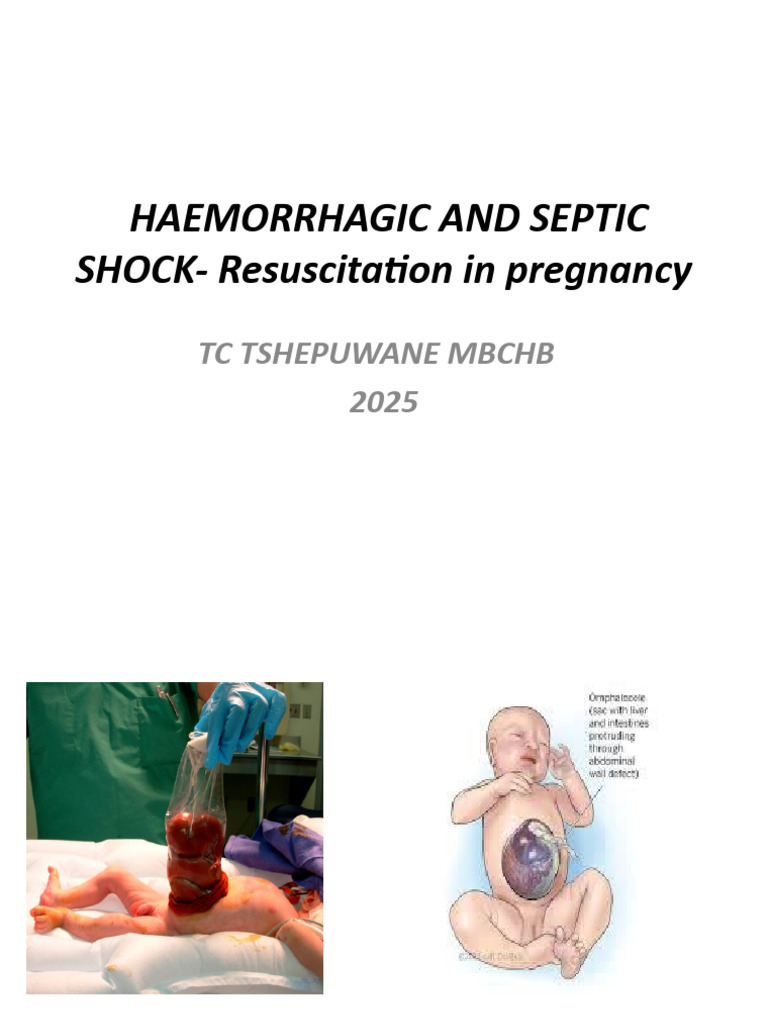 1 HAEMORRHAGIC AND SEPTIC SHOCK- MBCHB 2025 Resuscitation in pregnancy.pptx | PDF | Shock ...