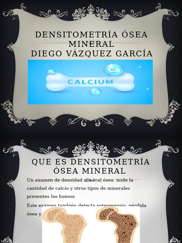 Densitometría ósea mineral | PDF | Osteoporosis | Hueso