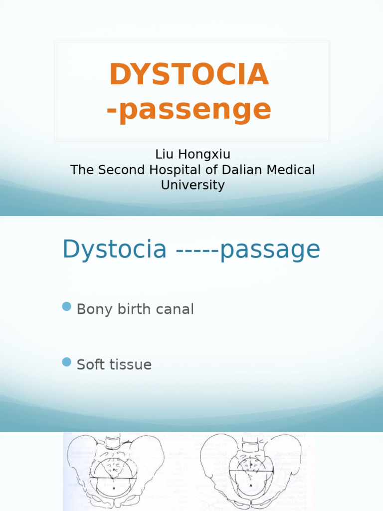 Understanding Dystocia and Its Types | PDF | Childbirth | Pelvis