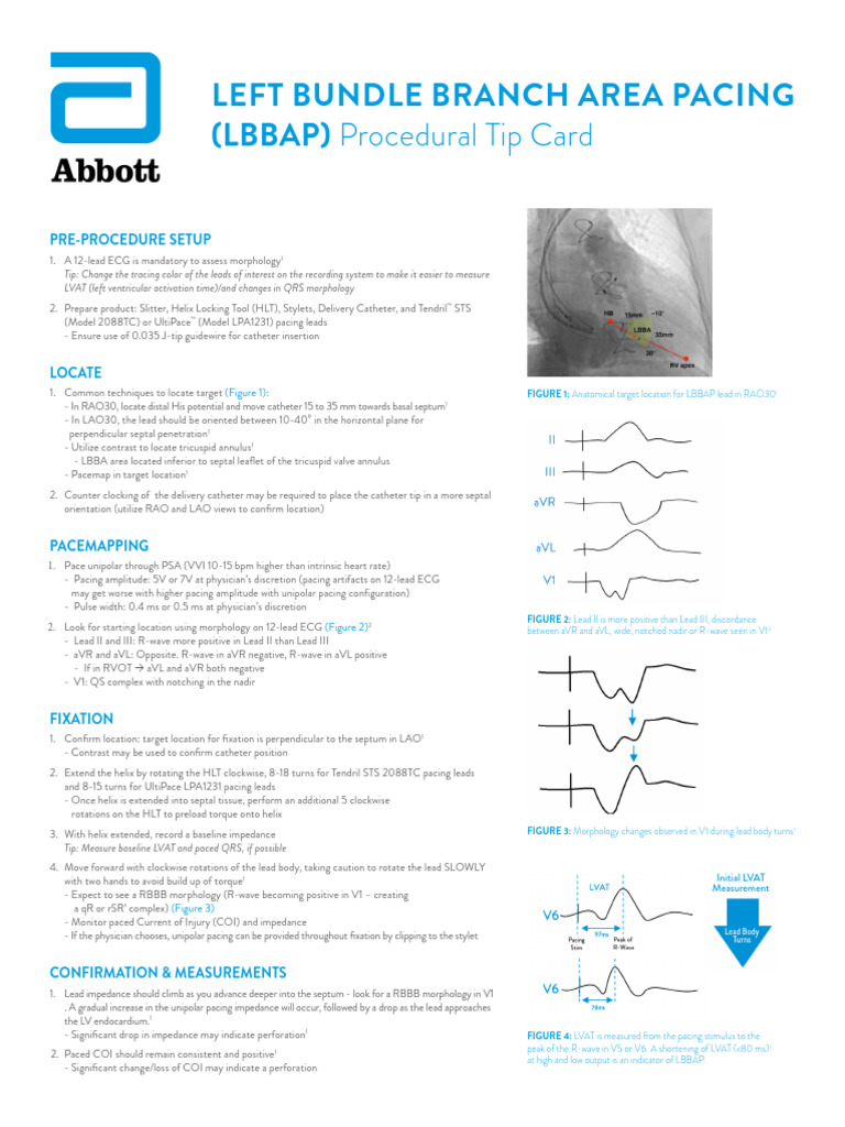 24-90697 Left Bundle Branch Area Pacing (LBBAP) Procedural Tip Card ...