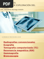 Radiografía de Tórax Normal - Patrón Intersticial | PDF | Pulmón | Tórax
