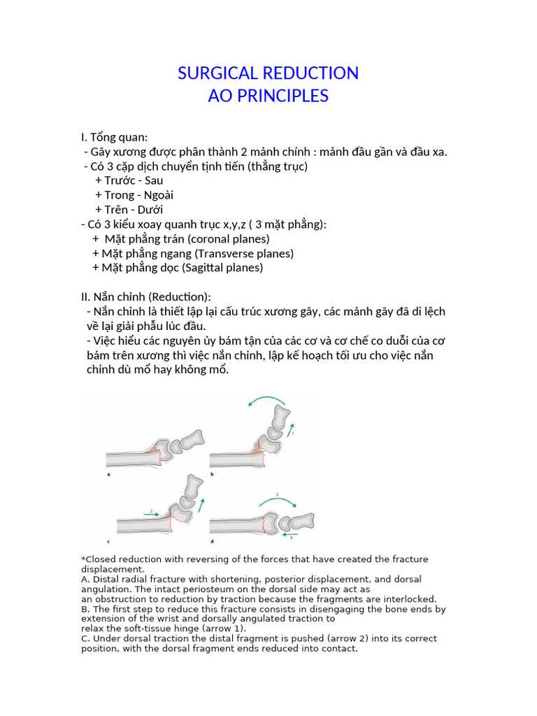 Surgical Reduction | PDF