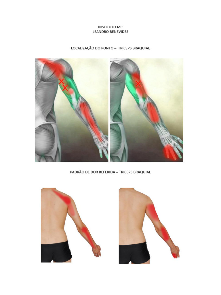 Dor Referida no Tríceps Braquial | PDF
