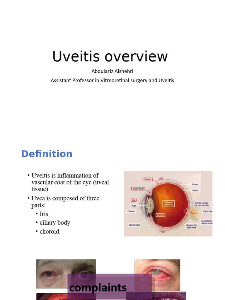 9 Uveitis Overview.pptx | PDF | Immunology | Human Diseases And Disorders