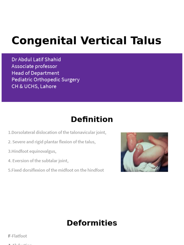 Congenital Vertical Talus | PDF | Foot | Ankle