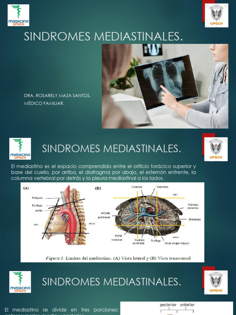 8.- Sindromes Mediastinales Corregido. | PDF | Linfoma | Enfermedades y trastornos