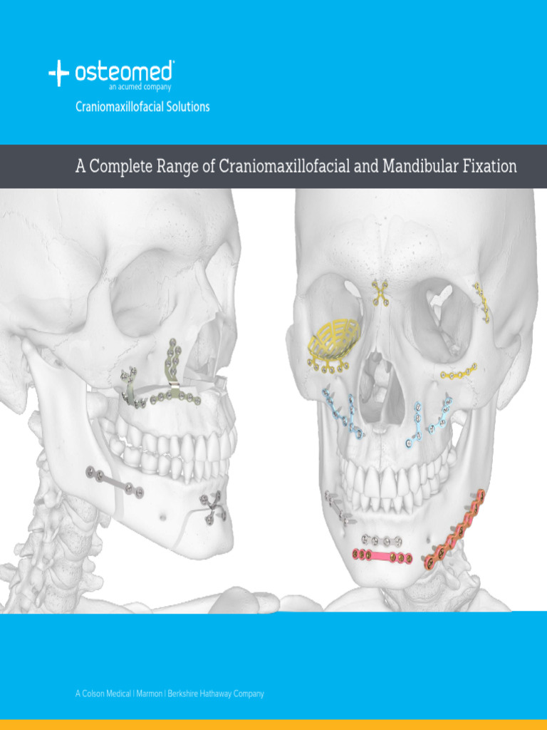 Acumed Brochure EN Ostemed CMF Comprehensive Solutions 030 2232 B | PDF ...