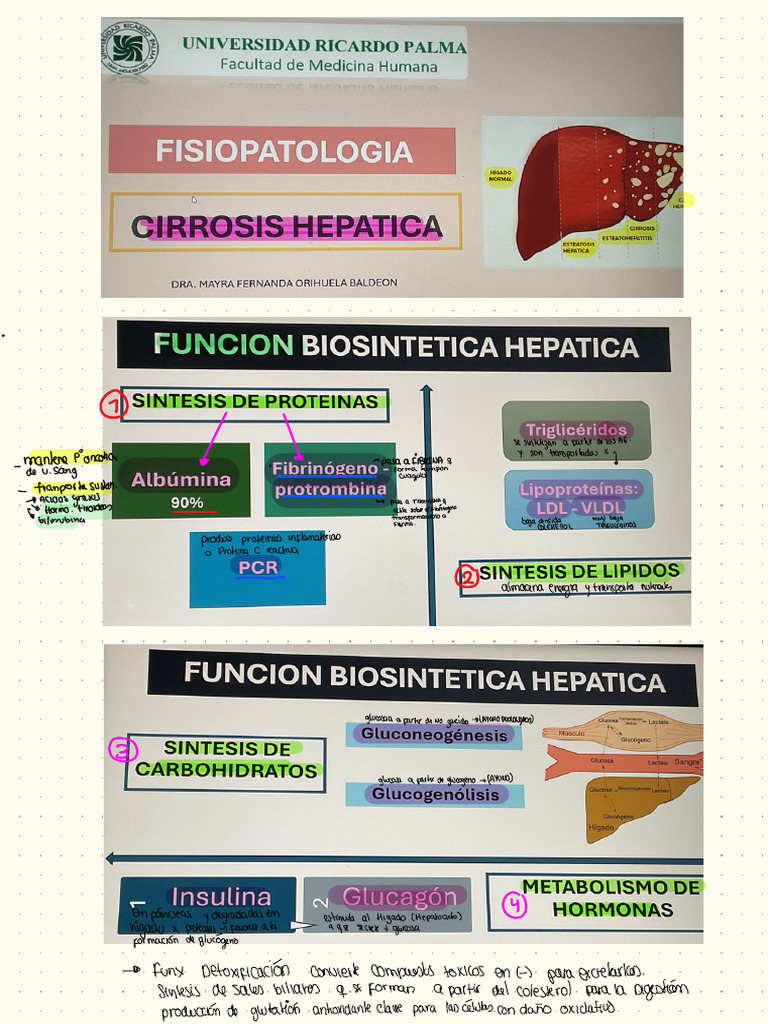 6-Cirrosis Hepatica | PDF