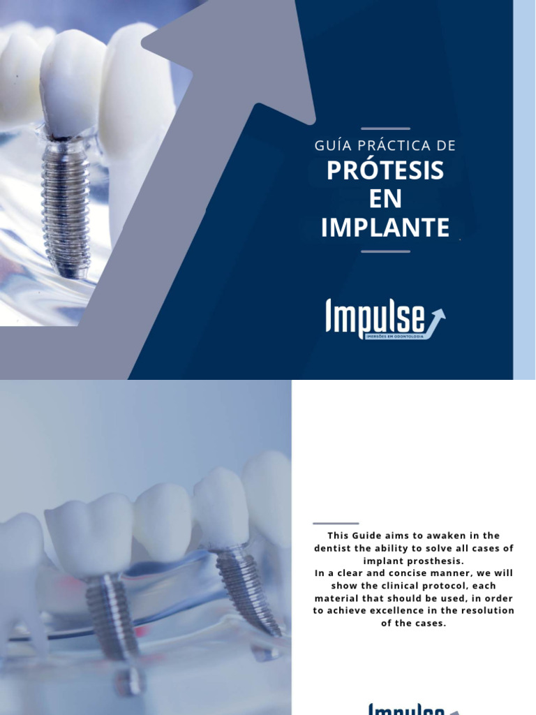 Protocolo de Prótesis en Implantes Dentales | PDF | Silicona | Implante ...