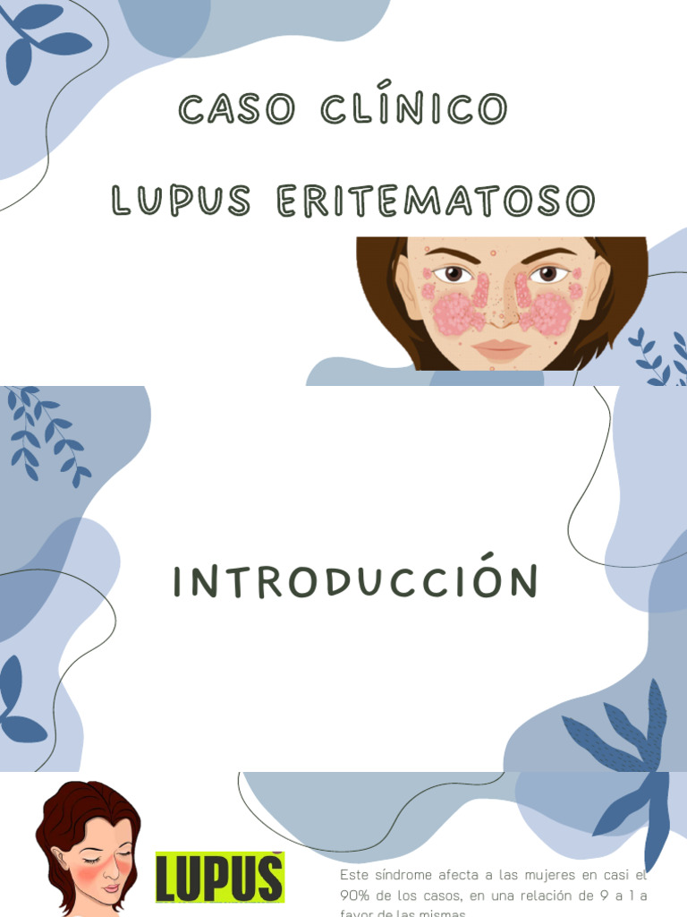 Diagnóstico y manejo del lupus eritematoso | PDF | Medicina CLINICA ...