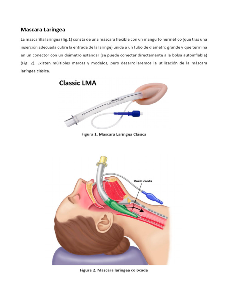 06 Mascara Laringea | PDF | Reanimación cardiopulmonar | Laringe