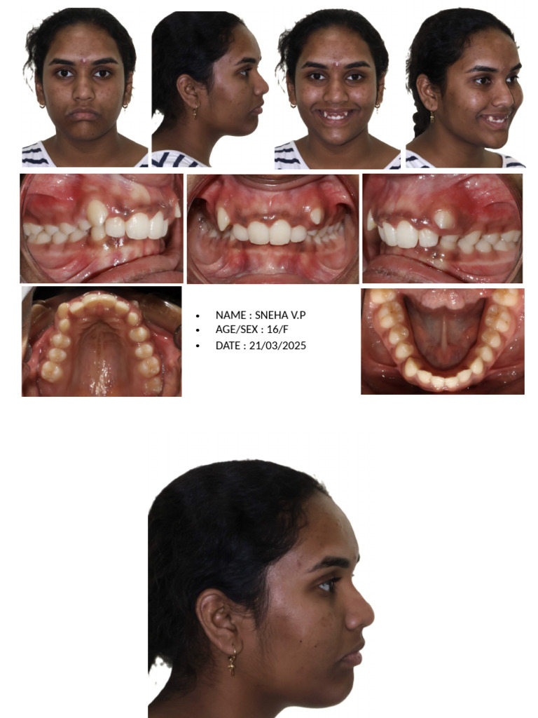 Sneha V P final | PDF