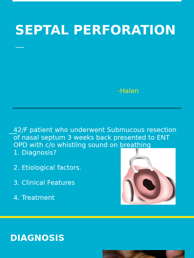 Septal Perforation | PDF