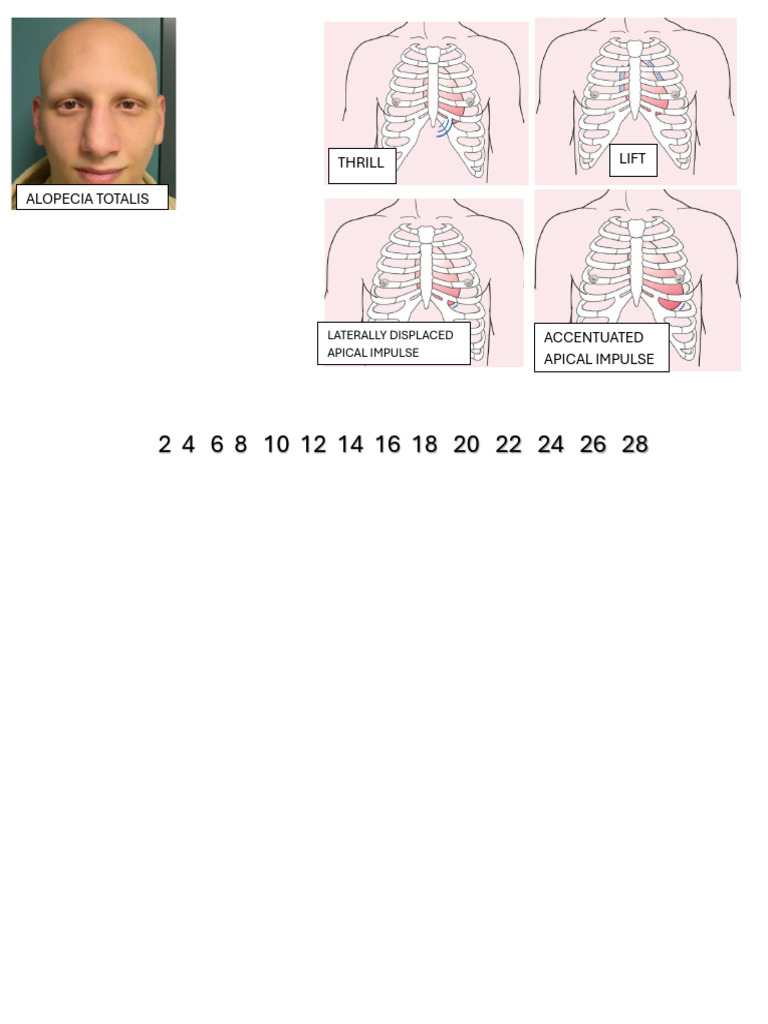 Alopecia Totalis and Heart Impulse Analysis | PDF