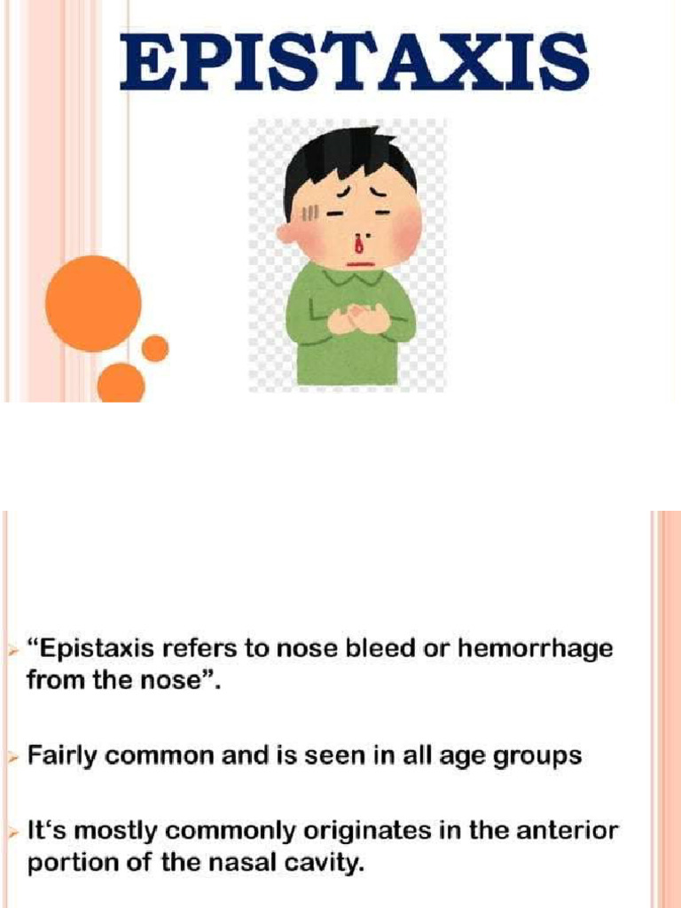 EPISTAXIS | PDF