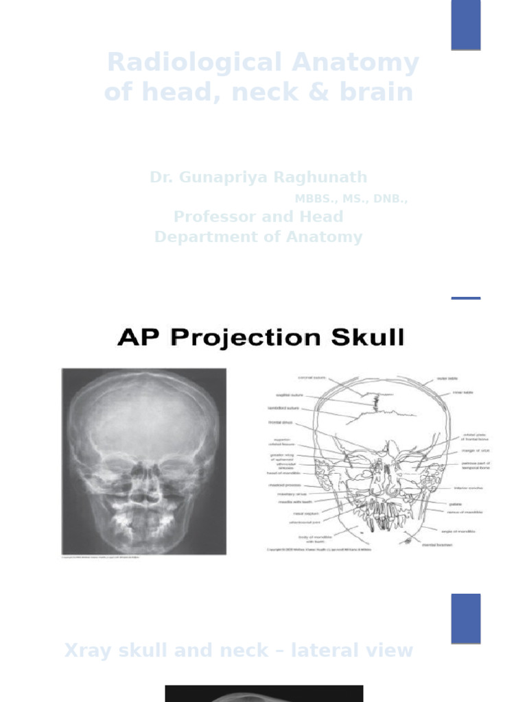 Radiological Anatomy of Head and Neck | PDF
