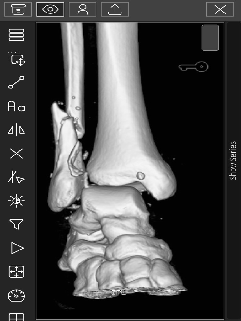 Radweb TelePACS | PDF