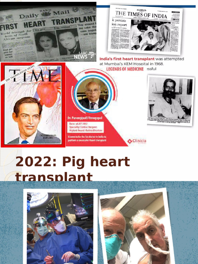 Lecture 8 Organ Transplant and THOA | PDF | Organ Transplantation ...