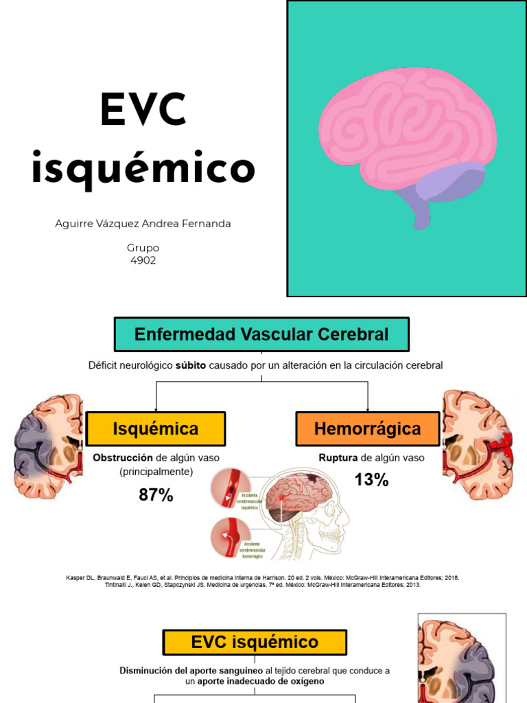 EVC Isquémico: Causas y Diagnóstico | PDF | Isquemia | Carrera