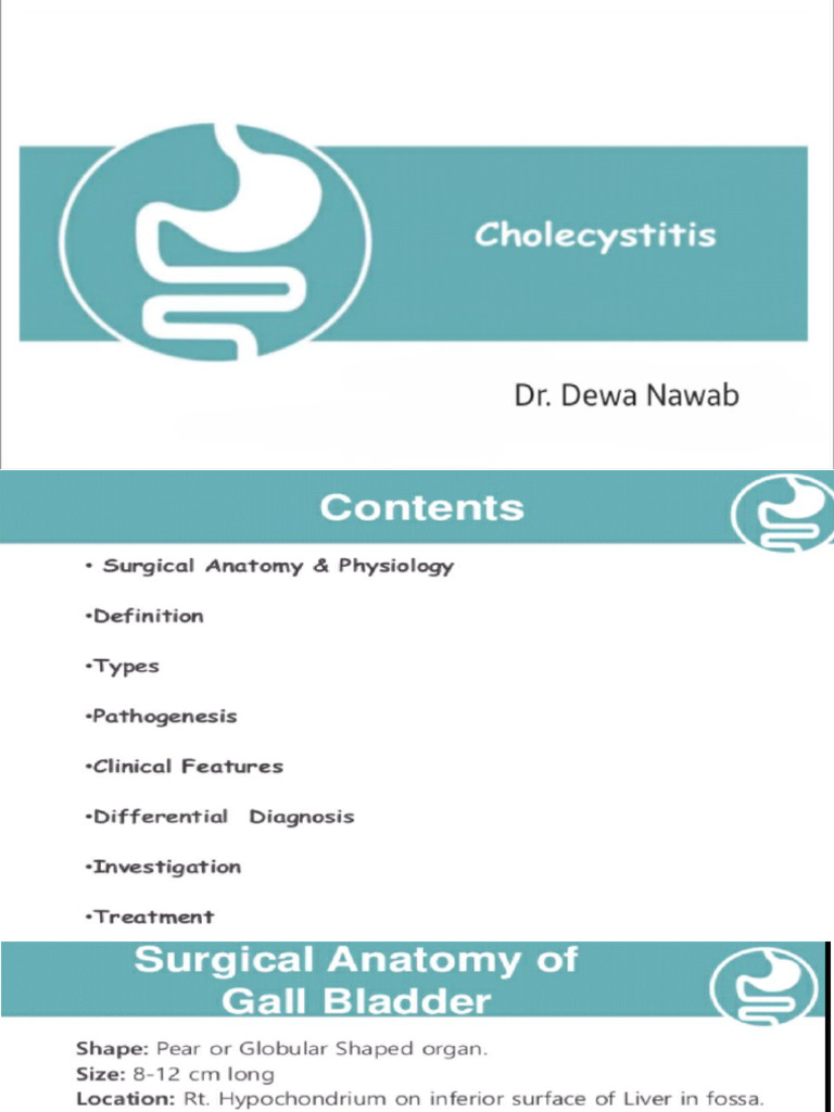 Chole Cystitis | PDF