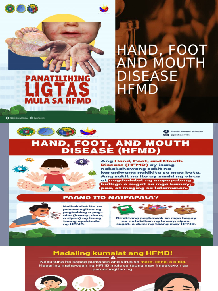 Understanding Hand, Foot, and Mouth Disease | PDF