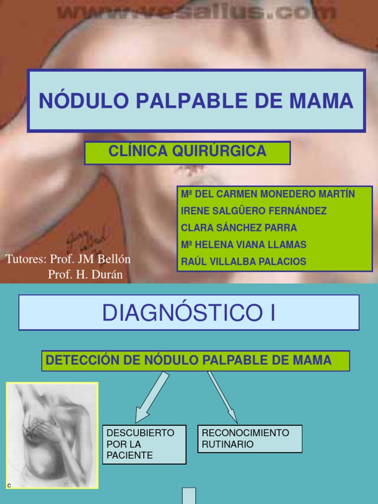 Nodulo Mama | PDF | Cáncer de mama | Biopsia