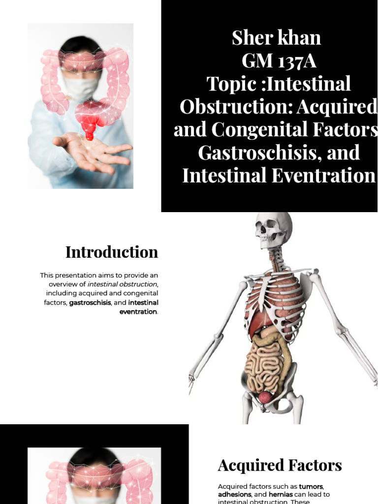 Intestinal Obstruction, Gastroschisis. Intestinal Eventration | PDF ...