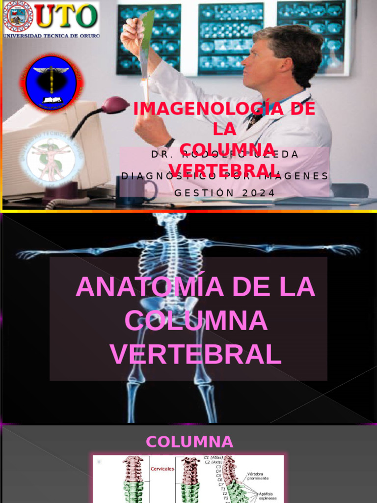 Tema 13 Imagenologia de La Columna Vertebral | PDF | La columna vertebral | Vértebra